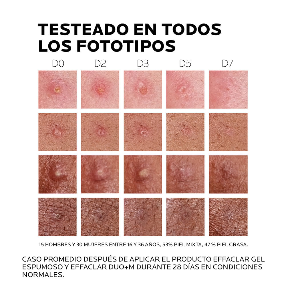 Tratamiento La Roche Posay Anti-Imperfecciones Effaclar Duo+M 40ml - Aruma